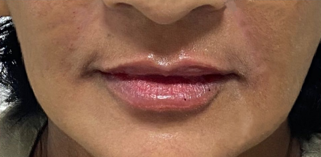 Before After - Christell Skin