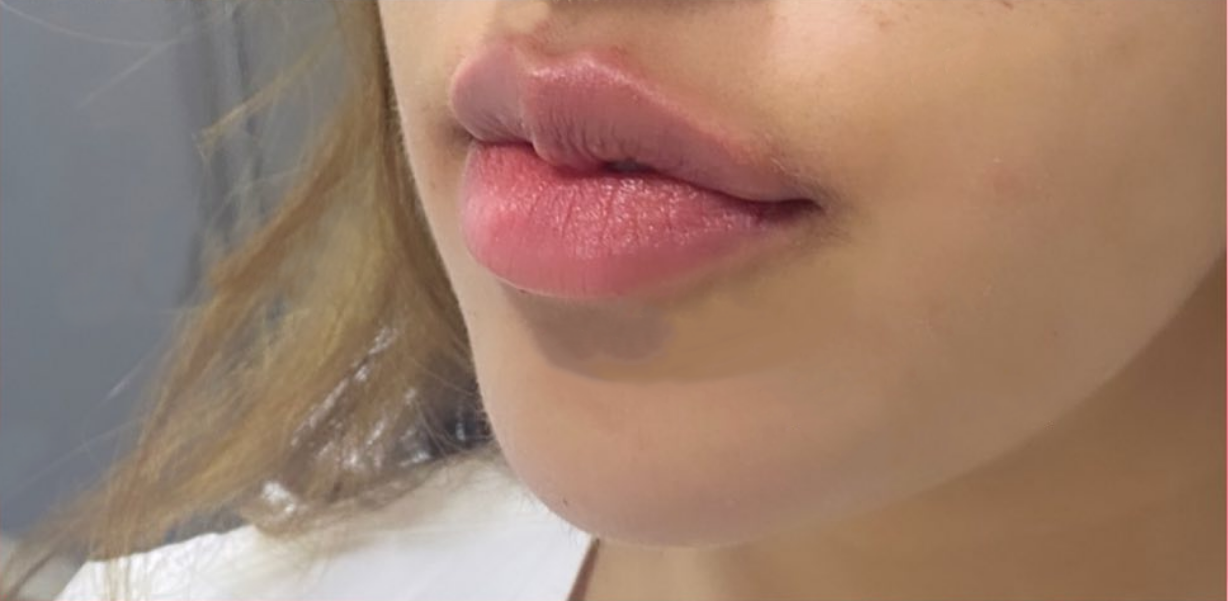 Before After - Christell Skin