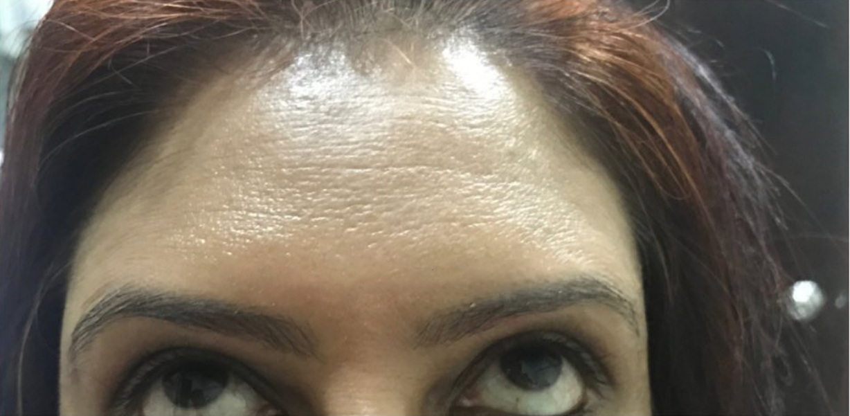 Before After - Christell Skin