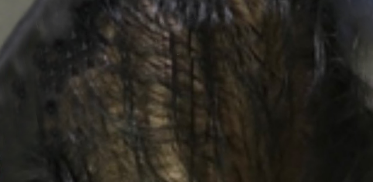 Before After - Christell Skin